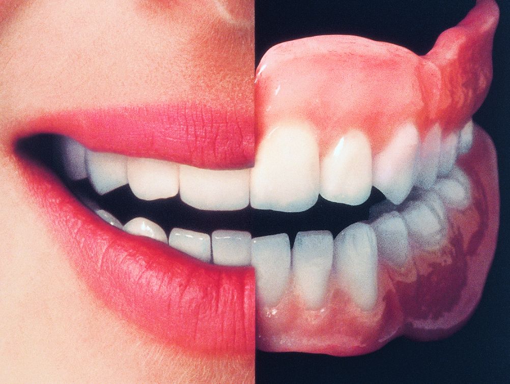 Onderhoud van de gebitsprothese